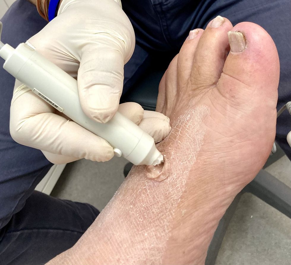 Doppler Ultrasound - AllSports and Family Podiatry Perth